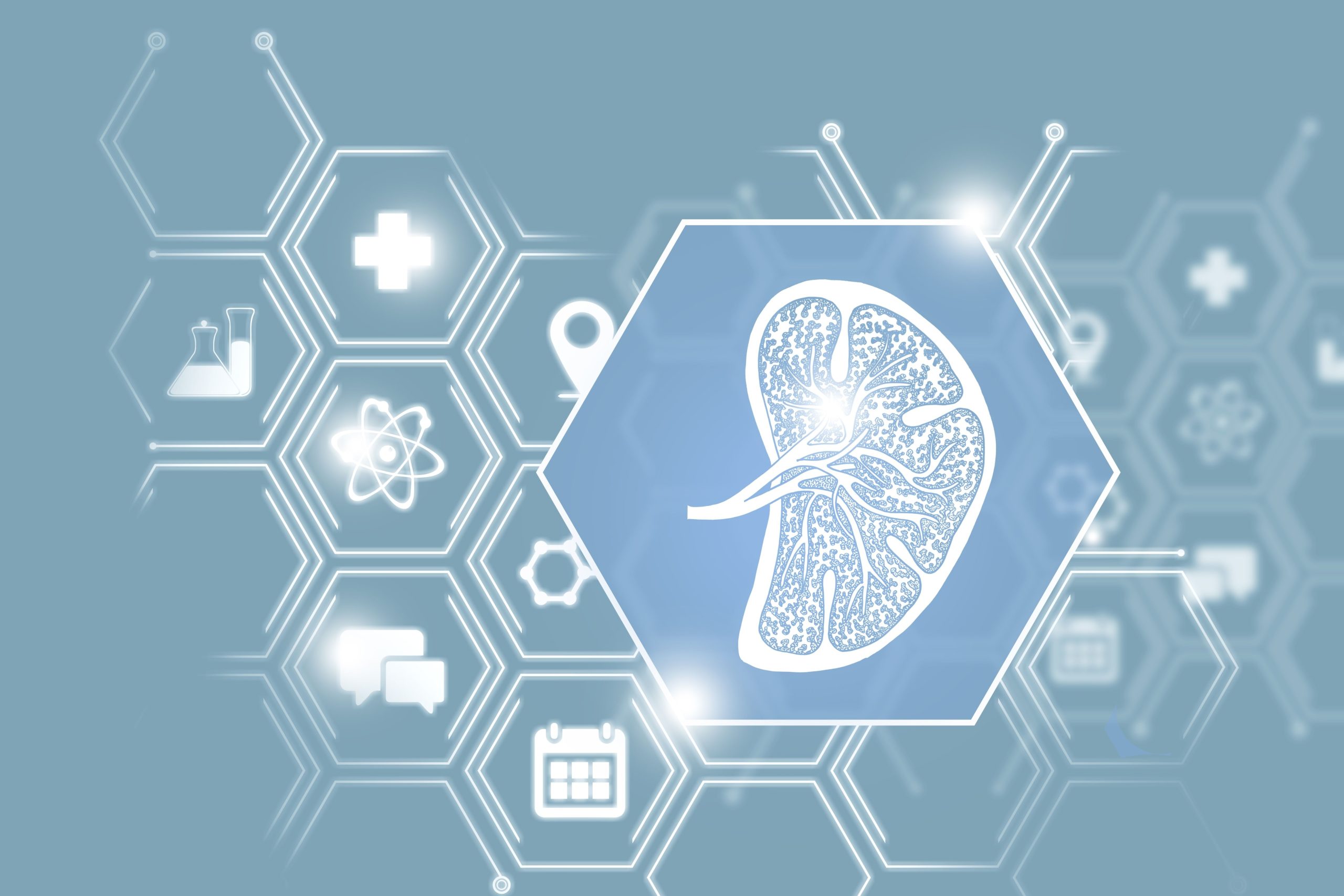 Splenectomy - LexiMed